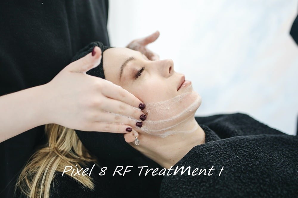 Understanding Pixel 8 RF: The Revolutionary Skin Treatment